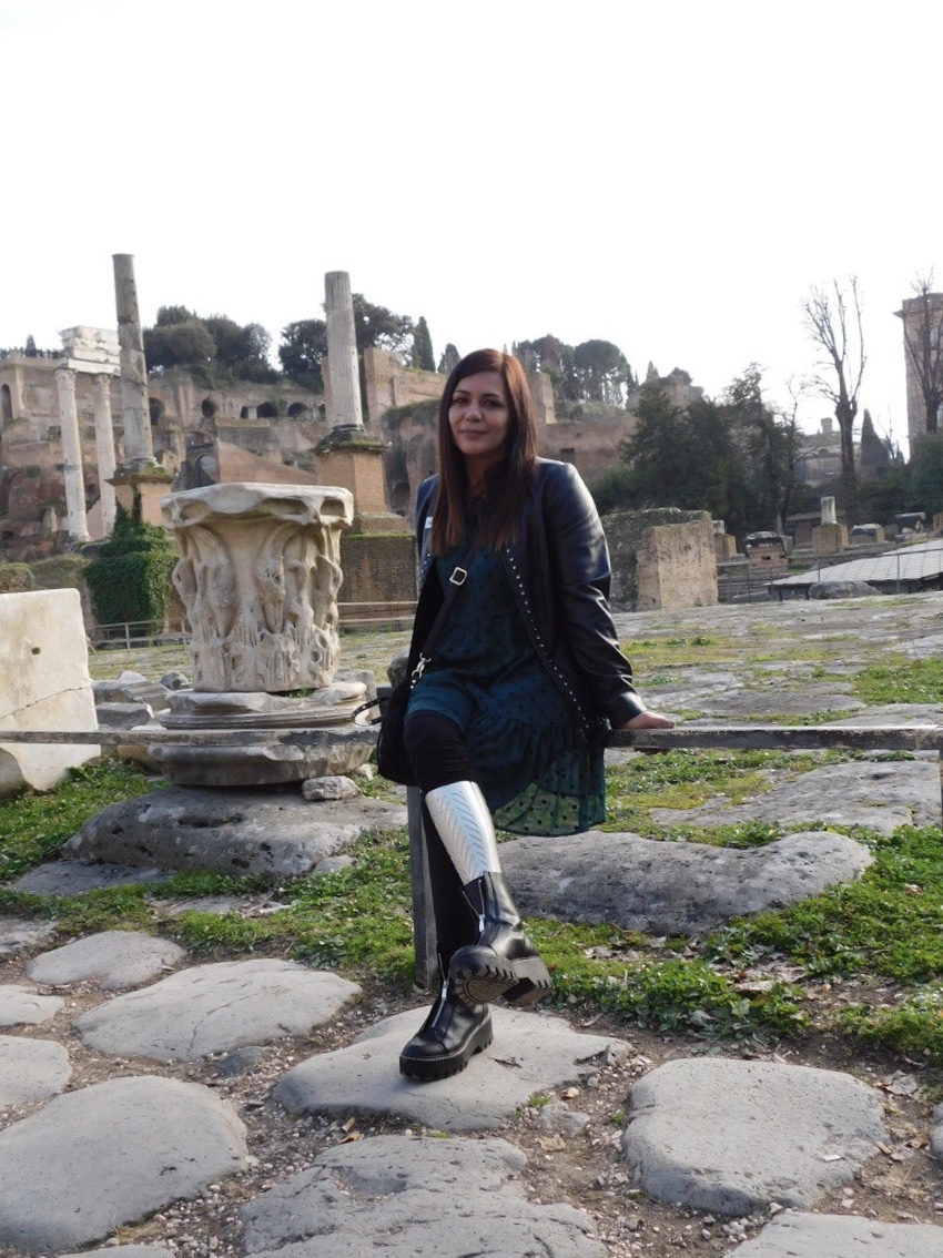 UNYQ Prosthetic covers