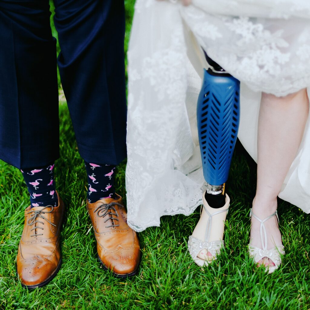 Amputees lifestyle Erin Deegan Conner