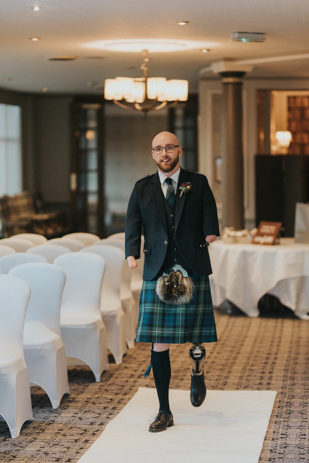 Amputees lifestyle – Martin Perry