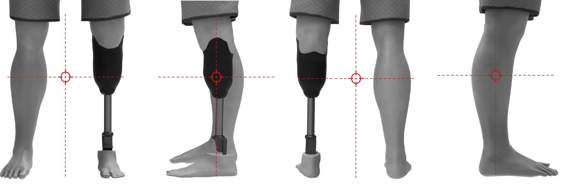 CustomFit | UNYQ Design Europe S.L.